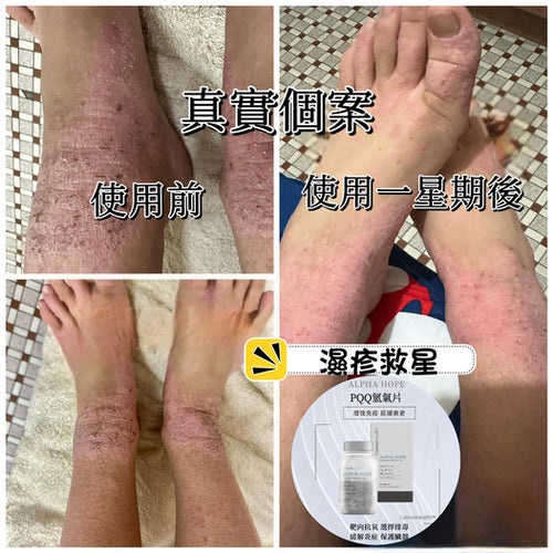 Alpha Hope PQQ 氫氣片 - Calerie Life 凱麗香港 – Noble Taste 尚級滋味